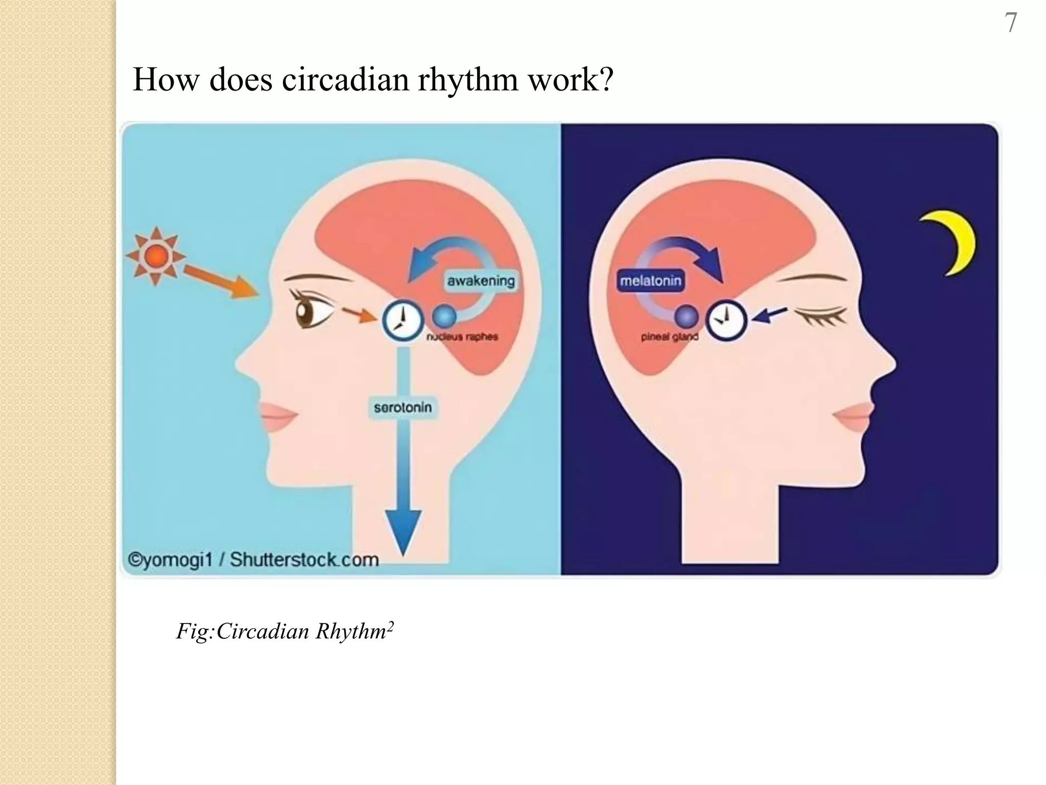 Delayed Sleep Phase Disorder(DSPD)[719].pptx