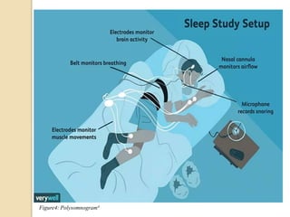 Delayed Sleep Phase Disorder(DSPD)[719].pptx
