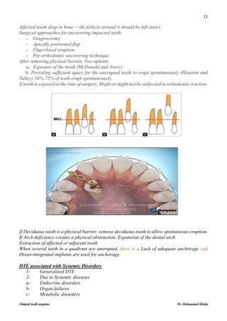Delayed Tooth Eruption and its clinical effects | PDF
