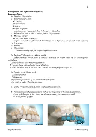 Delayed Tooth Eruption and its clinical effects | PDF