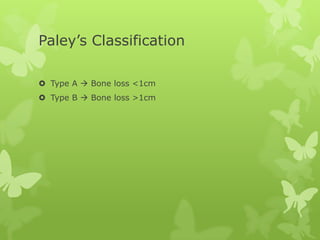 Delayed union and non union | PPTX