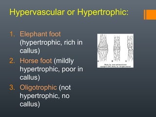 Delayed Union & Nonunion of Fractures | PPT