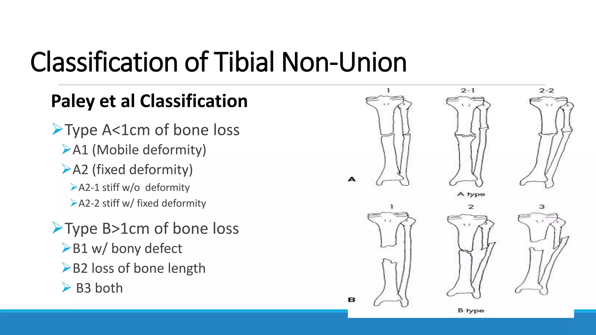 Delayed Unions and Nonunion | PPTX