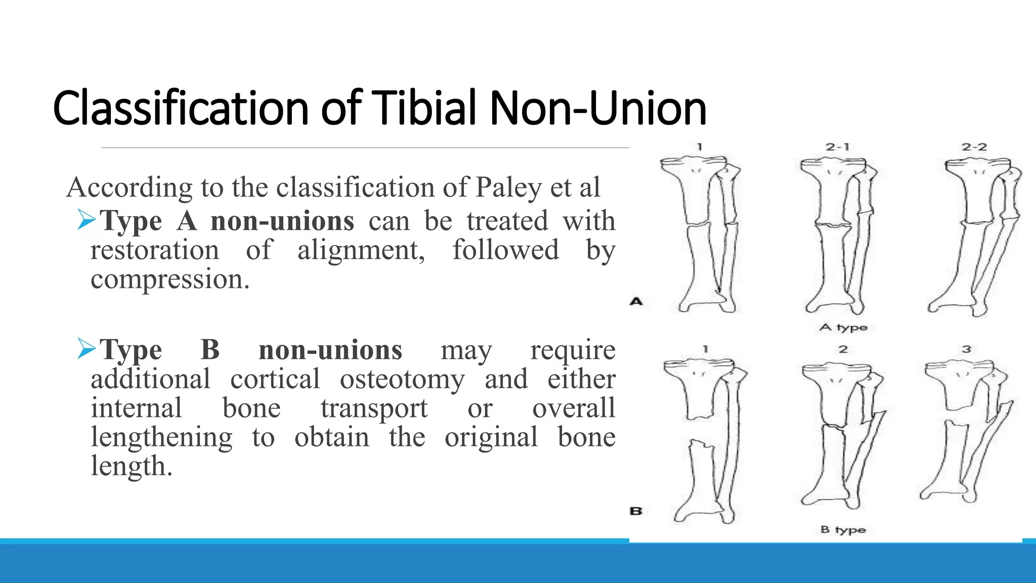 Delayed Unions and Nonunion | PPTX