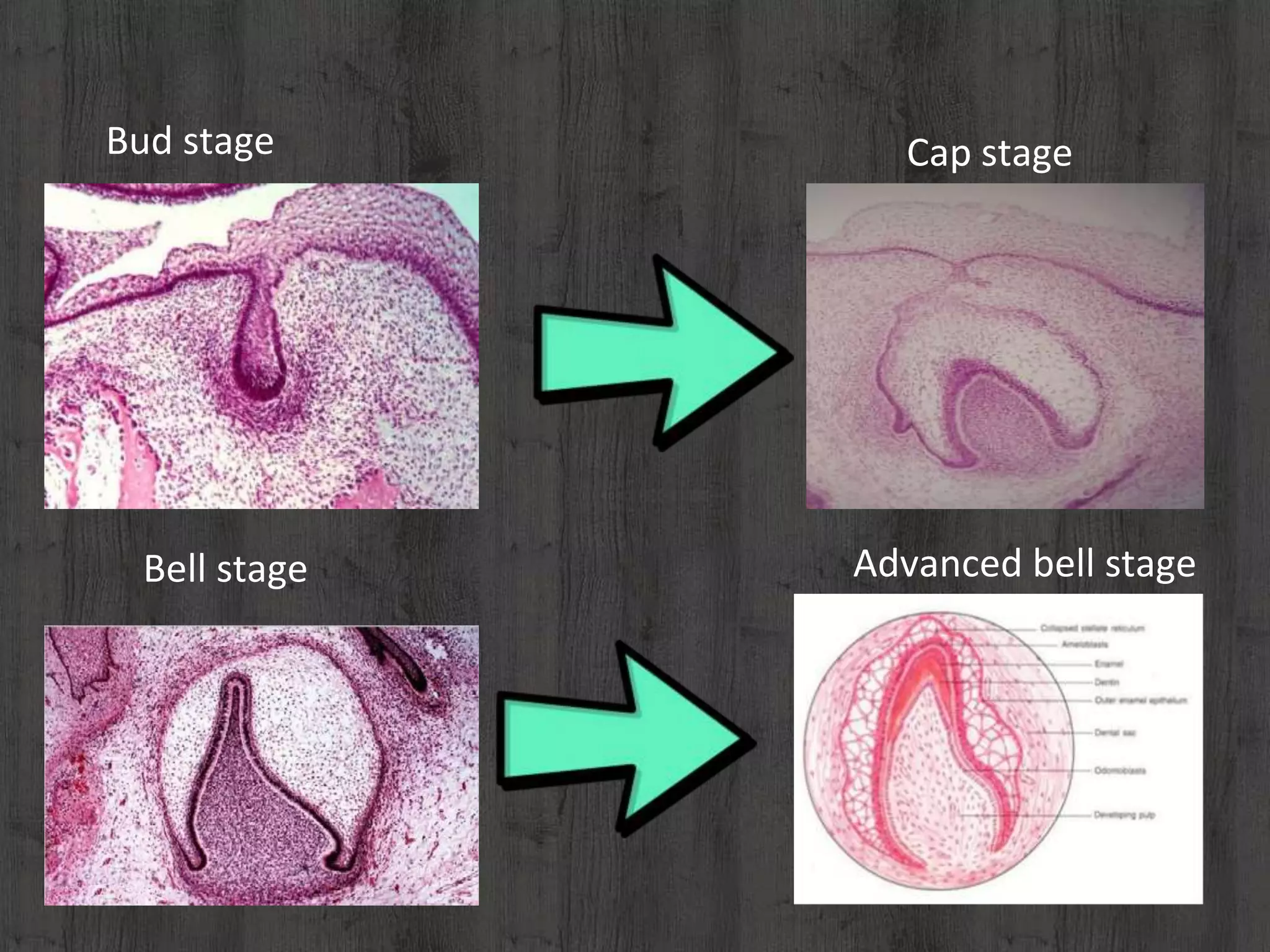 Role of growth spurts in tooth development - oral medicine and ...