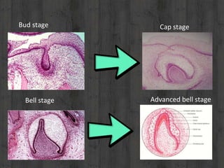 Role of growth spurts in tooth development - oral medicine and ...