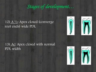 Role of growth spurts in tooth development - oral medicine and ...