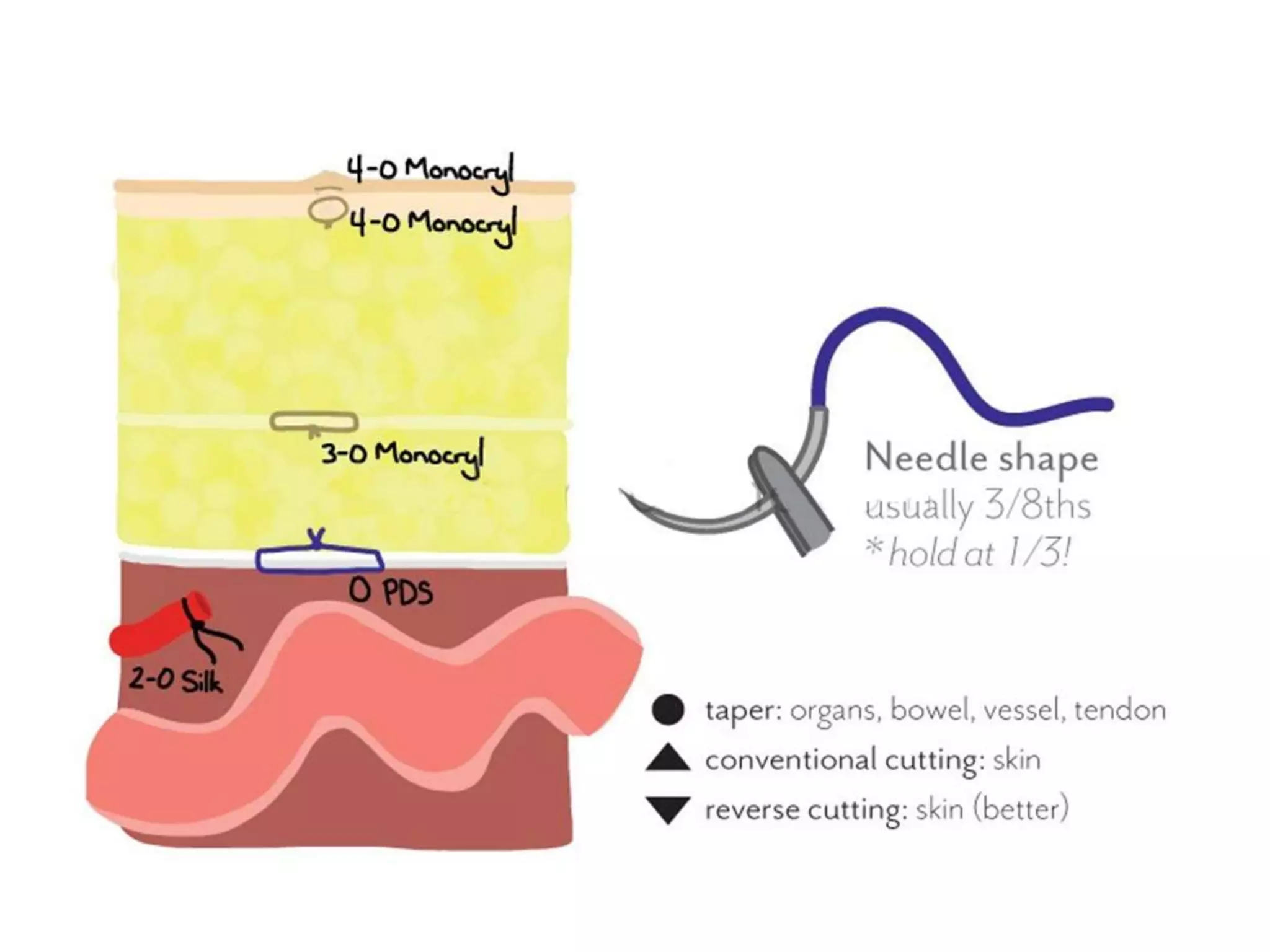 Suturing 101 - Basic Surgical Skills for Medical Students and Junior ...