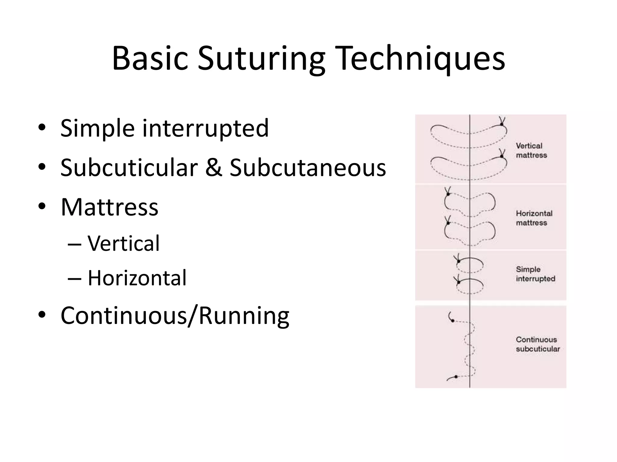 Suturing 101 - Basic Surgical Skills for Medical Students and Junior ...