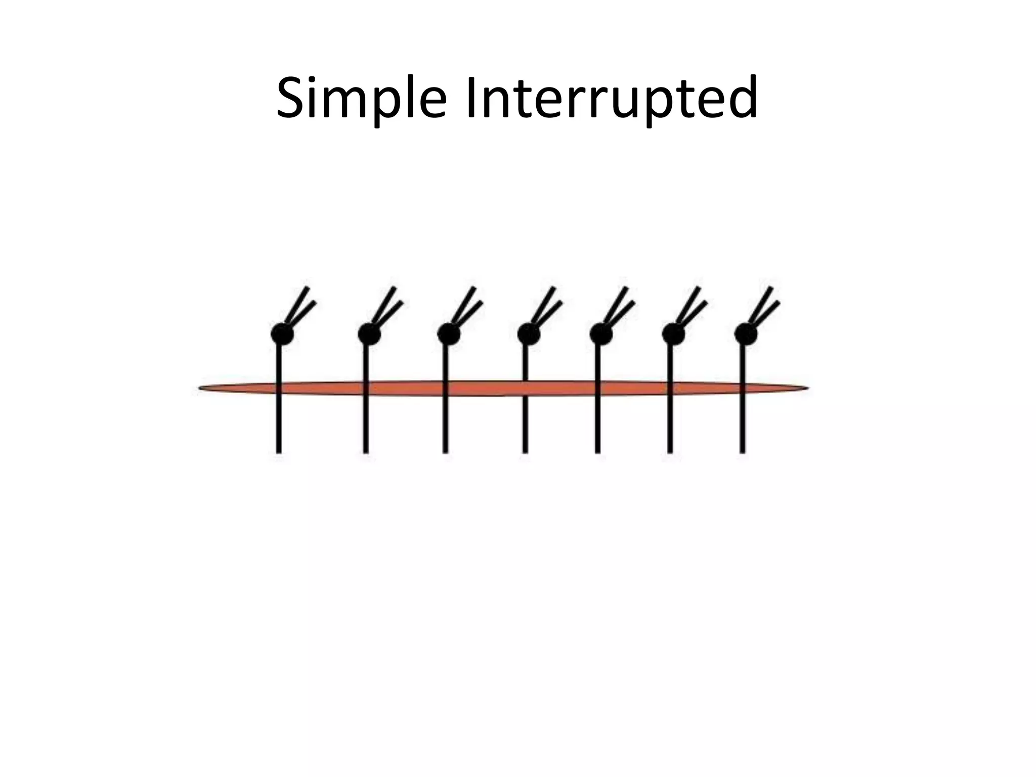 Suturing 101 - Basic Surgical Skills for Medical Students and Junior ...