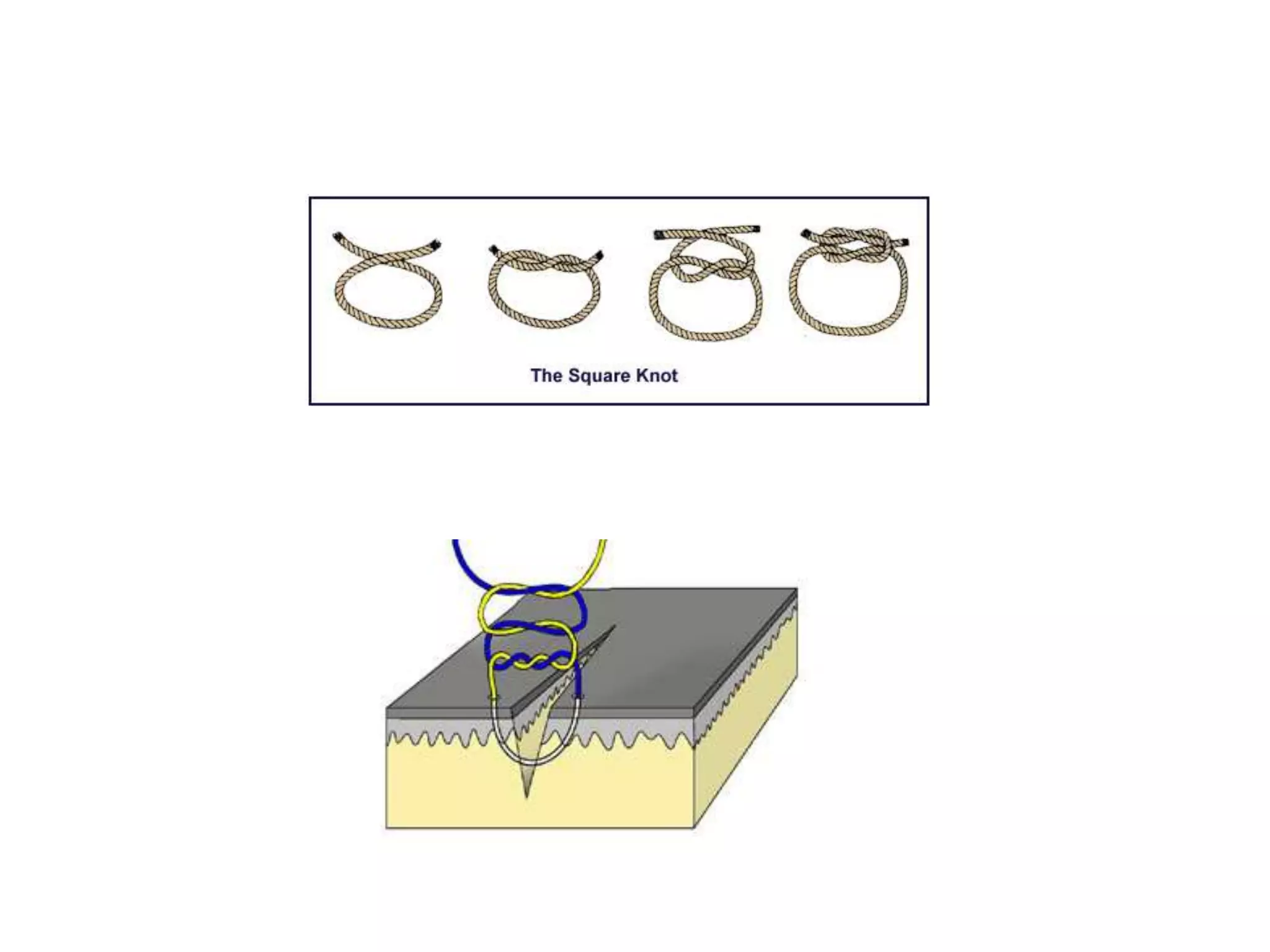 Suturing 101 - Basic Surgical Skills for Medical Students and Junior ...