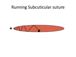 Suturing 101 - Basic Surgical Skills for Medical Students and Junior ...