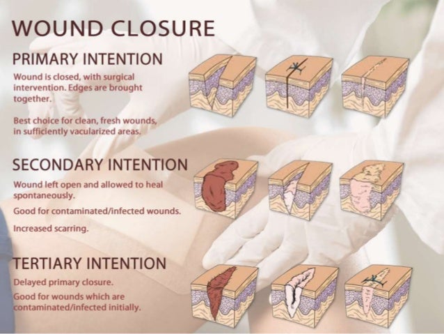 Suturing 101 - Basic Surgical Skills for Medical Students and Junior