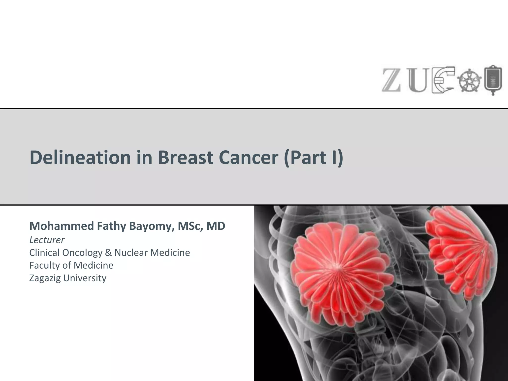 Delineation of breast cancer part i | PPTX