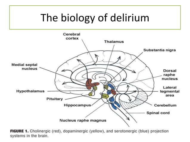 Delirium, dementia and other mental disorder due to brain dysfunction ...