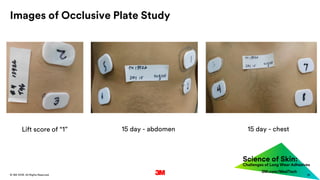 Science of Skin: Challenges of Long Wear Adhesives | PDF