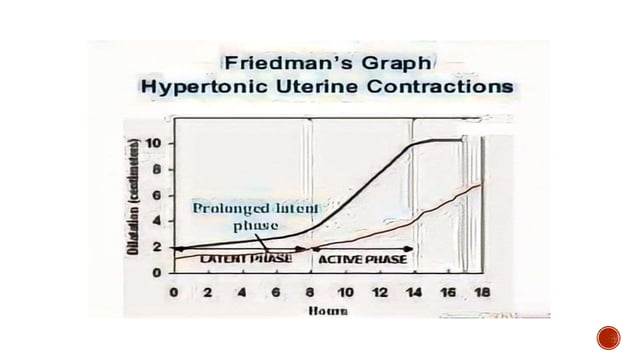Delovino, Hypertonic uterine contractions.pptx