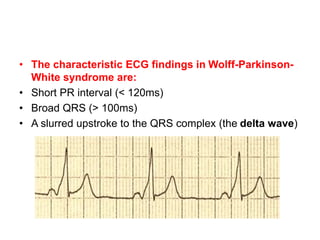 DDELTA WAVE IN ECG AND ITS INTERPRETATION IN ECG | PPTX