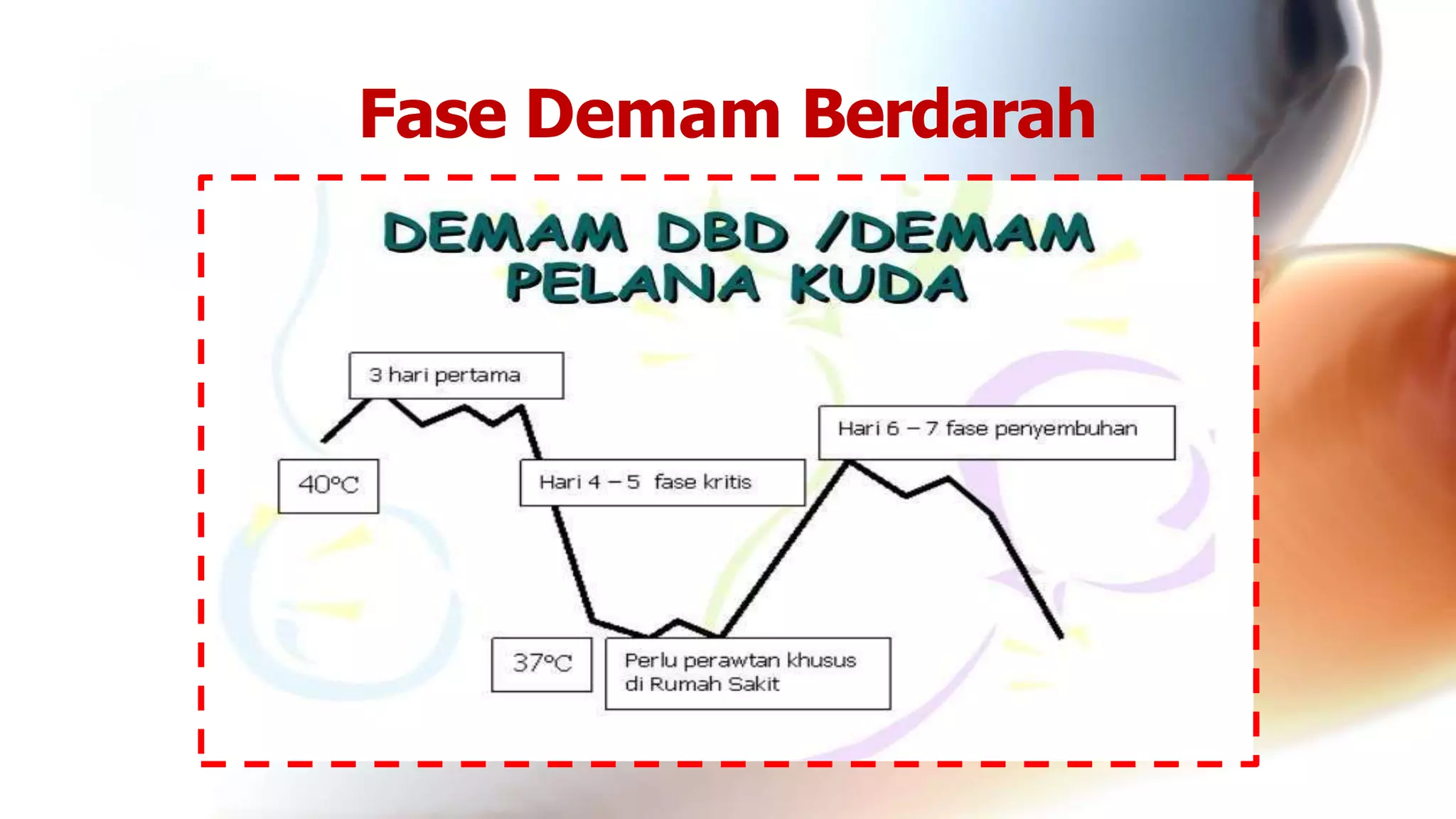 Demam Berdarah Dengue.pptx