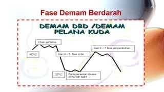 Demam Berdarah Dengue presentasi OK.pptx