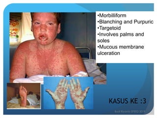 Demam dan rash dr.budi riyanto | PPT