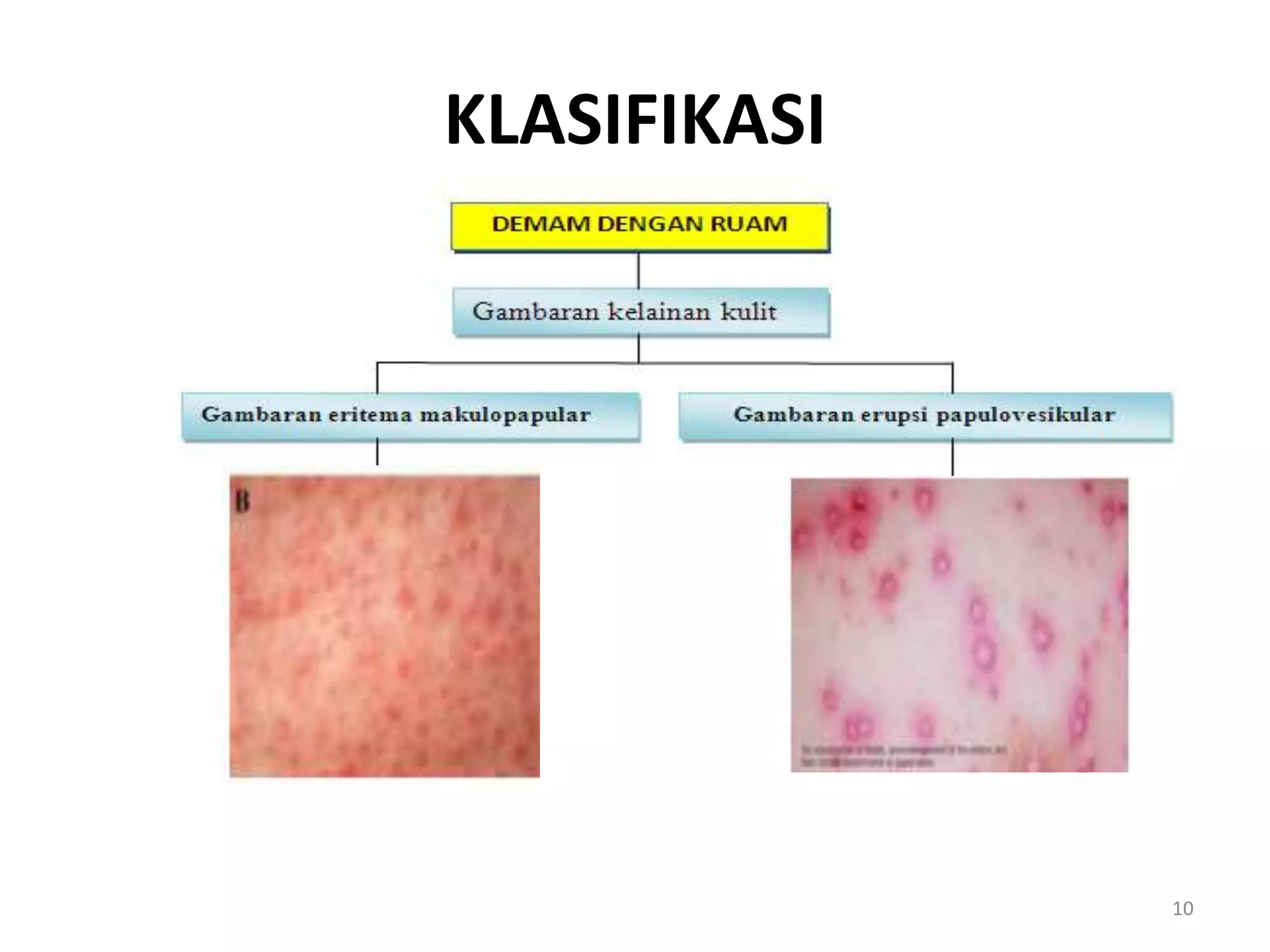 DEMAM DAN RUAM.pptx