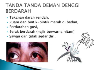 Deman denggi dan deman denggi berdarah | PPTX