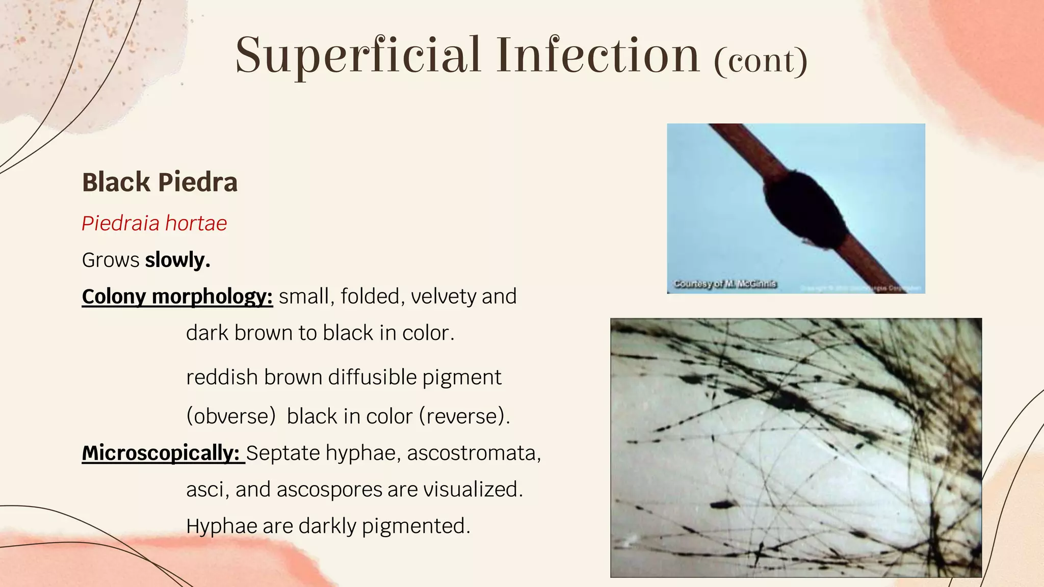 Dematiaceous fungi.pptx