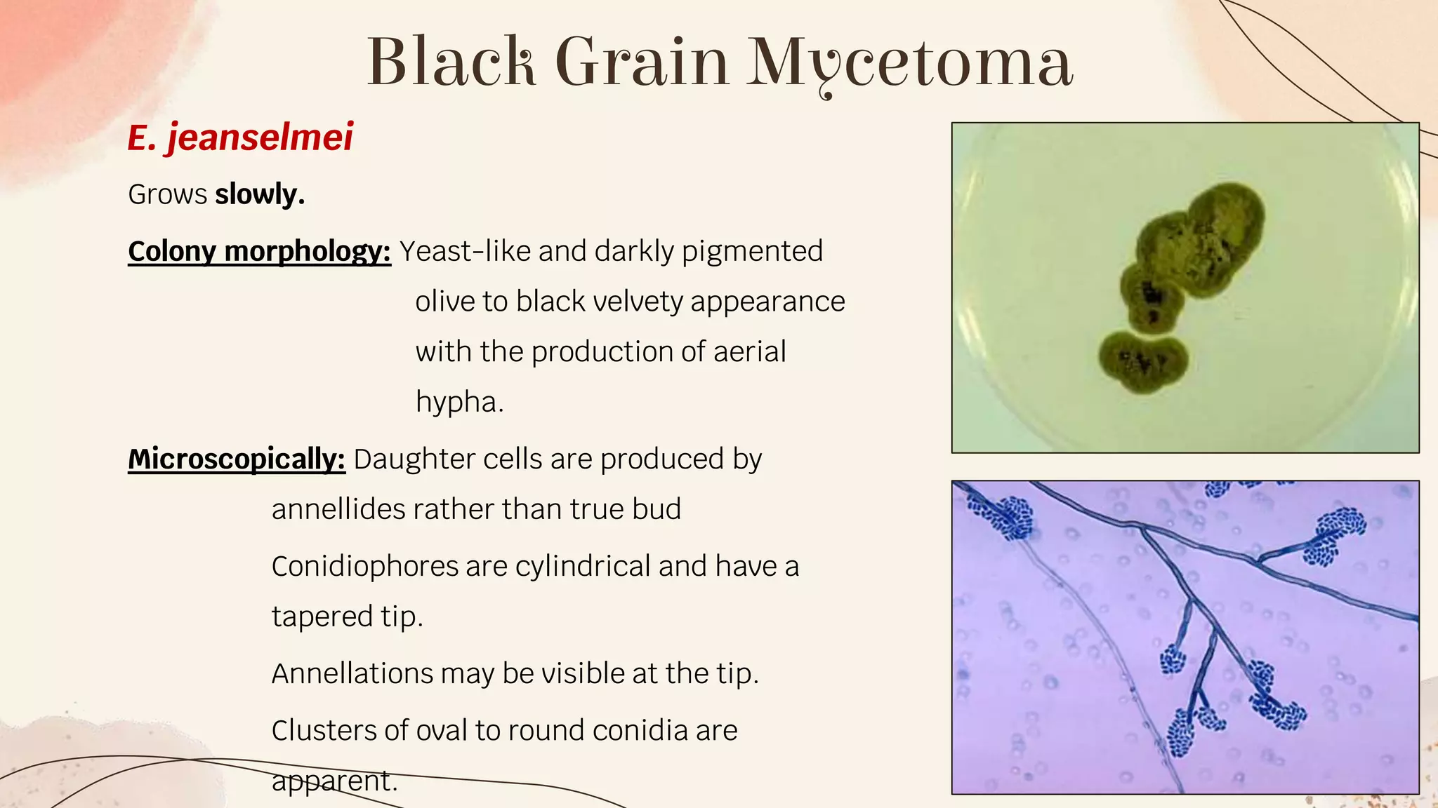 Dematiaceous fungi.pptx
