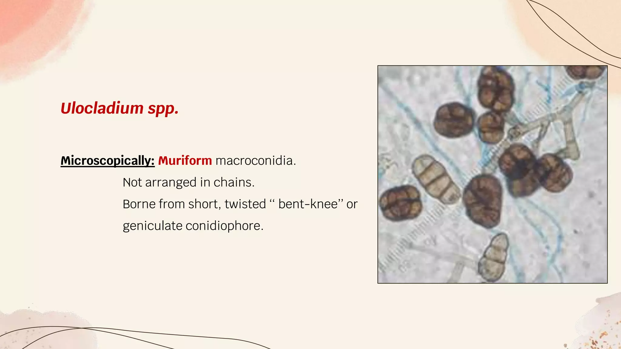 Dematiaceous fungi.pptx