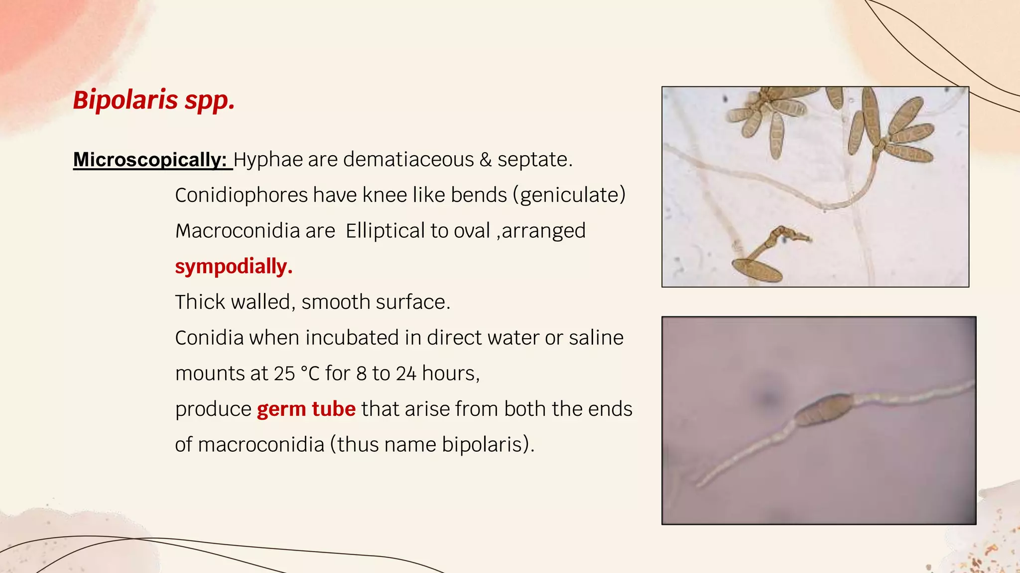 Dematiaceous fungi.pptx