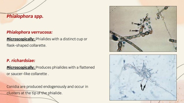 Dematiaceous fungi.pptx