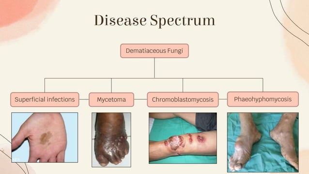 Dematiaceous fungi.pptx