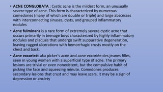 Acne dermatology 1.pptx