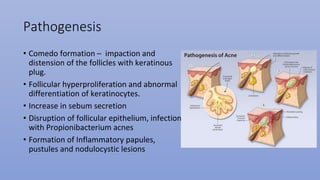 Acne dermatology 1.pptx
