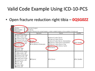Fracture Coding CM and PCS | PPTX