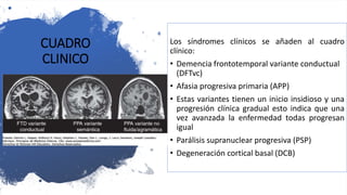 Demencia frontotemporal | PPTX