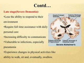 Dementia | PPTX