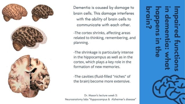 Memory loss Dementia | PPTX