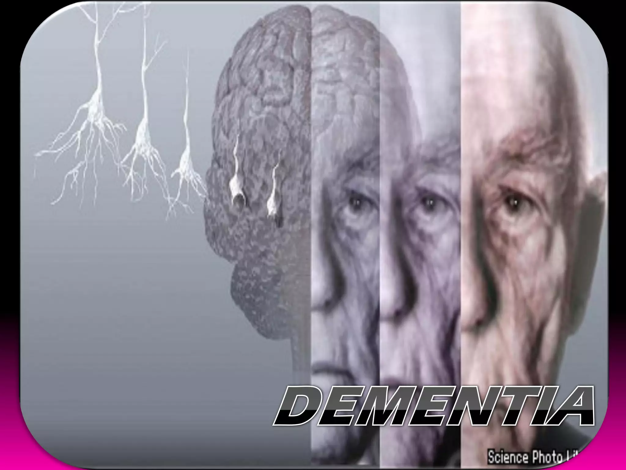 SHAAKERA SUBJEE AND SHAREEKA ANGAMIA-DEMENTIA PRESENTATION | PPT