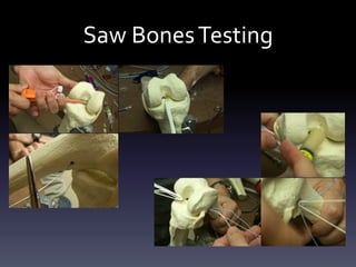 Demineralized Bone Matrix | PDF