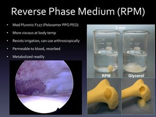 Demineralized Bone Matrix | PPT
