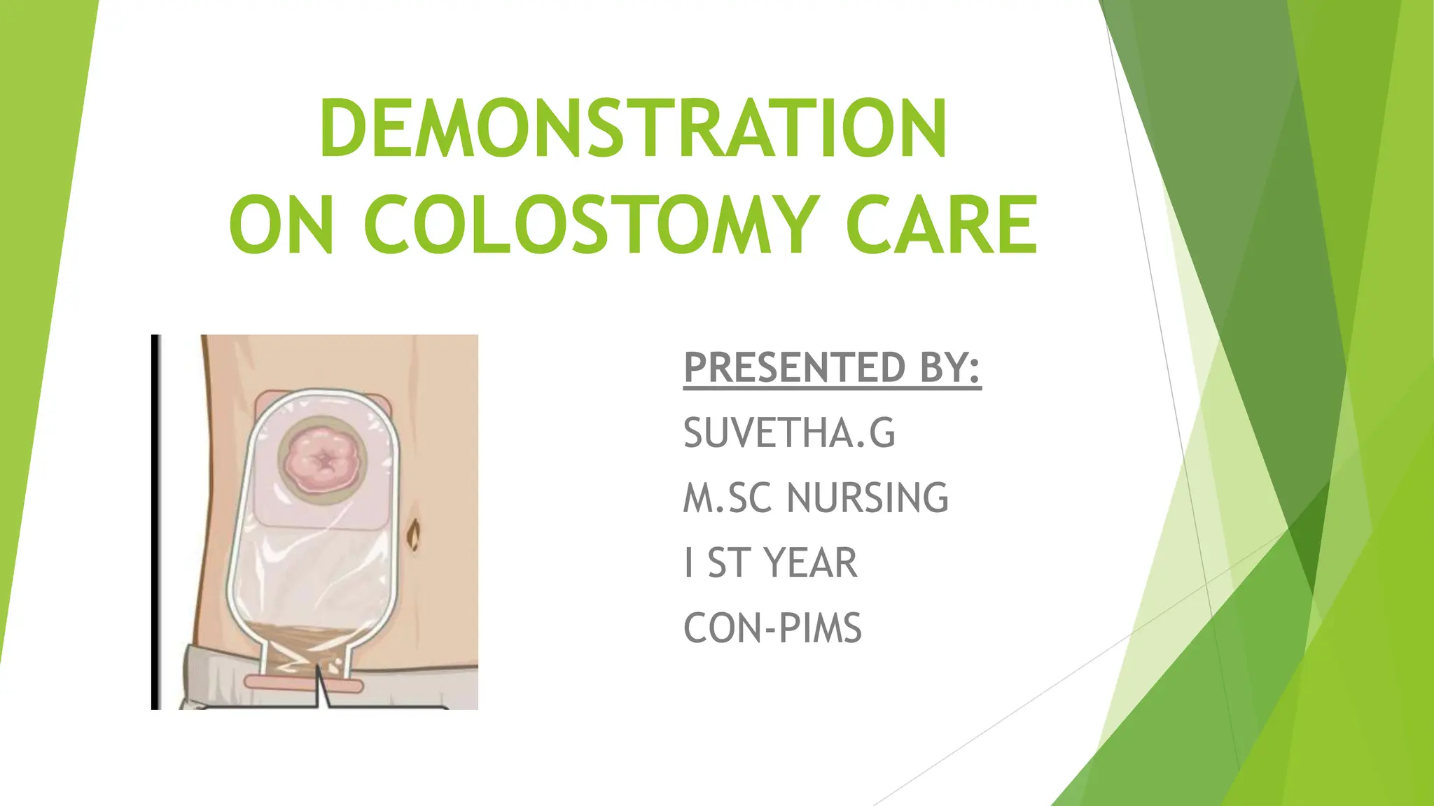 demo colostomy.pptx in child health nursing | PPTX