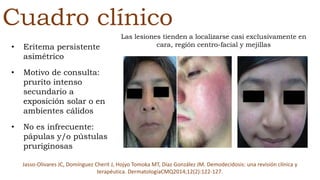 Demodicosis (Demodecidosis) | PPTX