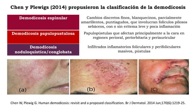 Demodicosis (Demodecidosis) | PPT