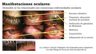 Demodicosis (Demodecidosis) | PPTX