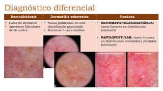 Demodicosis (Demodecidosis) | PPTX