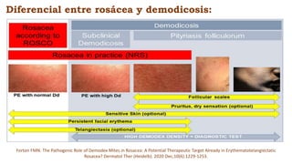 Demodicosis (Demodecidosis) | PPTX