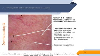 DEMODECIDOSIS MARIA ROCHA DERMATO.pptx