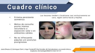 DEMODECIDOSIS MARIA ROCHA DERMATO.pptx